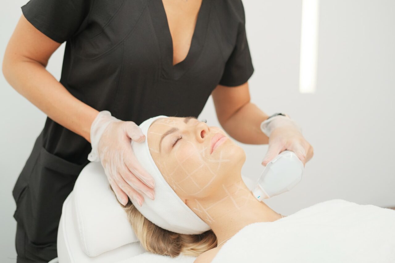 RF Microneedling Full face • Skin tightening • Acne scars • 3 sessions ...